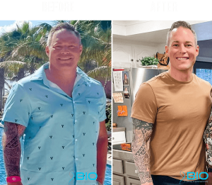 Tirzepatide Weight Loss Treatment in United States